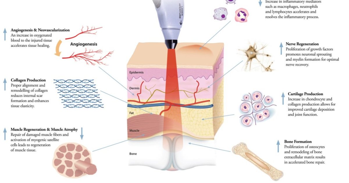 Photo Bio Modulation : Modes d'action - Centre médical de Grône